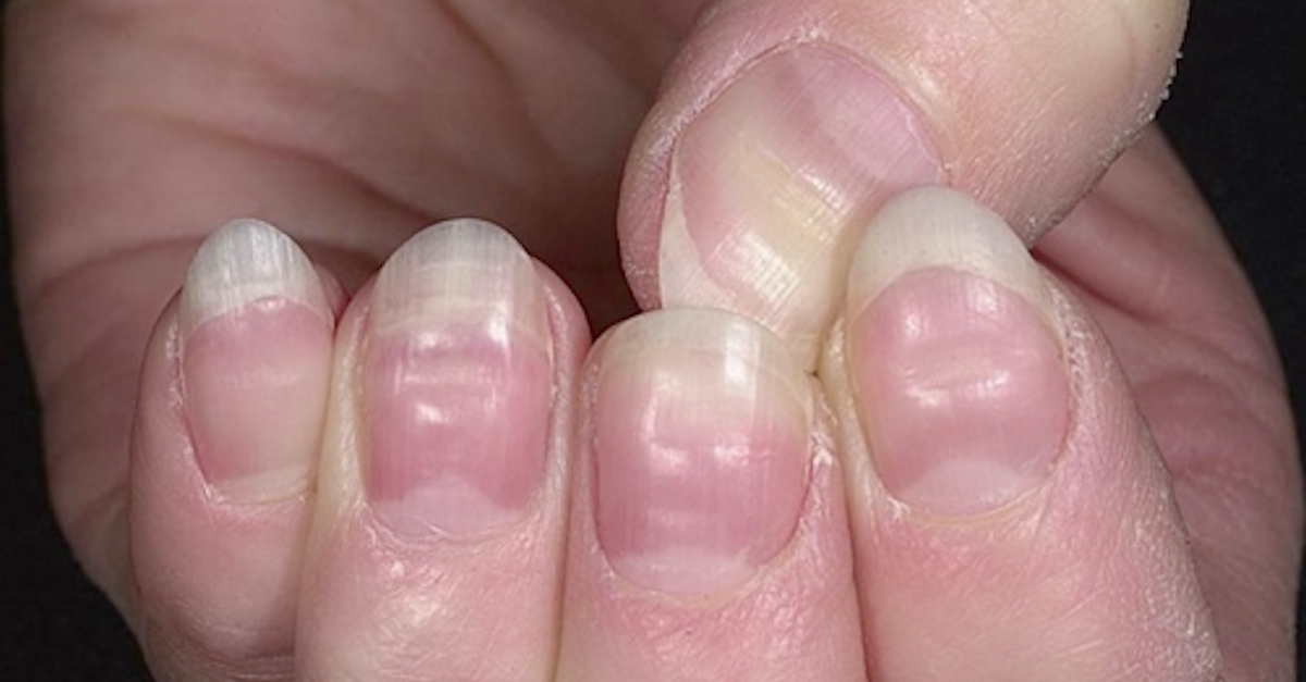 3 Signs Your Nails Will Reveal About Your Health | Pamper.My